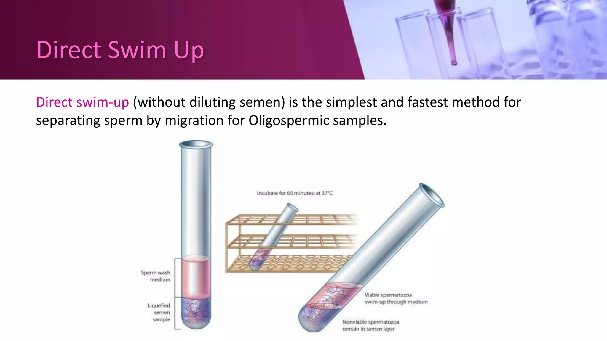 Semen Preparation Methods - Principles & Techniques | PPTX