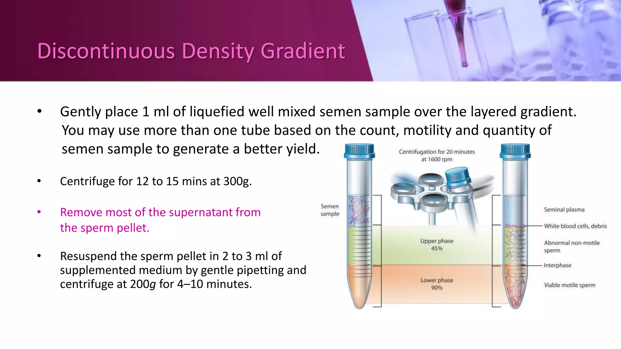 Semen Preparation Methods - Principles & Techniques | PPTX