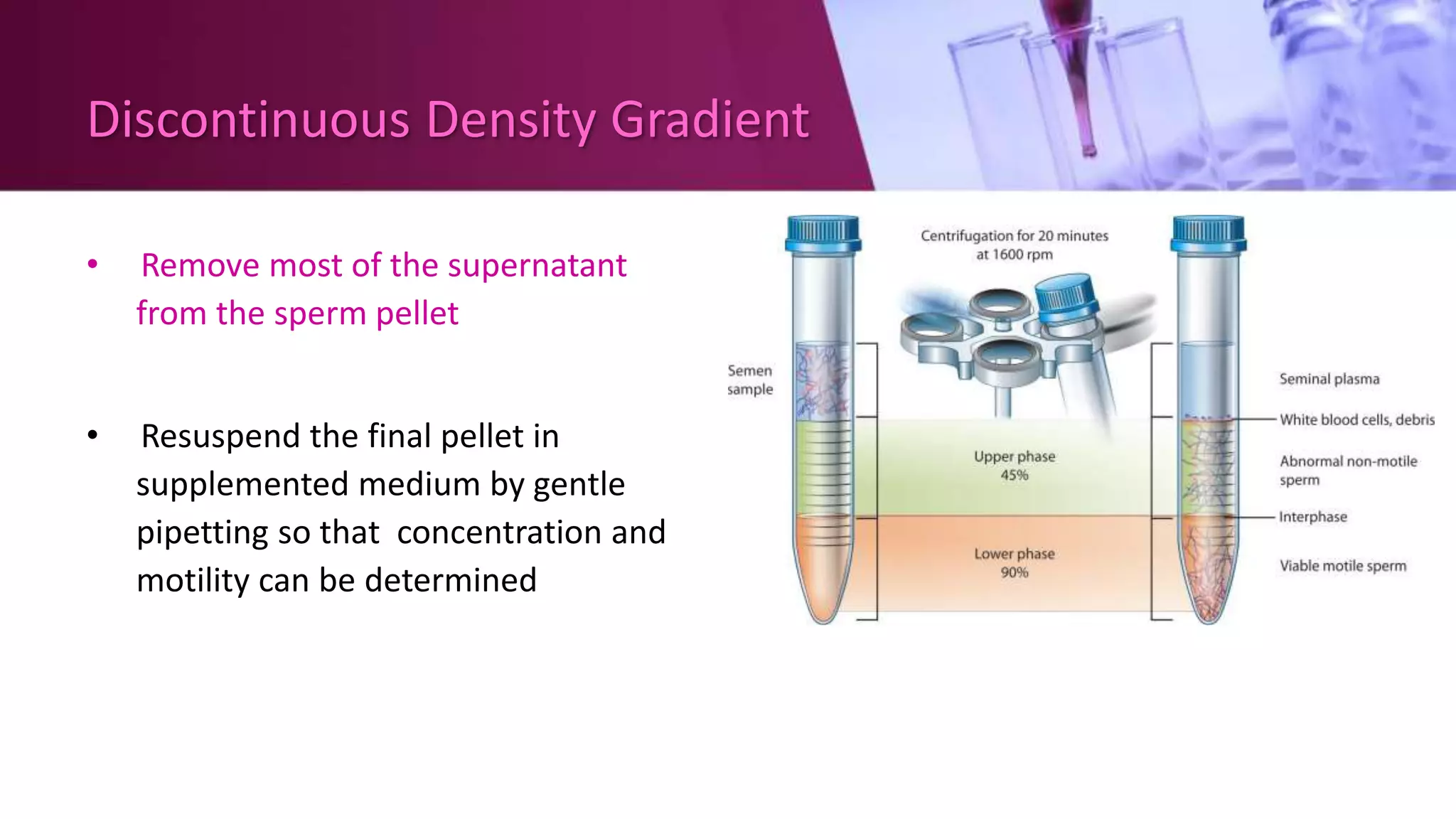 Semen Preparation Methods - Principles & Techniques | PPTX