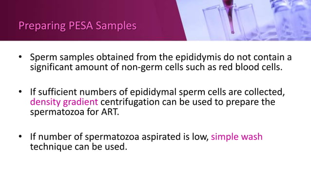 Semen Preparation Methods - Principles & Techniques | PPTX