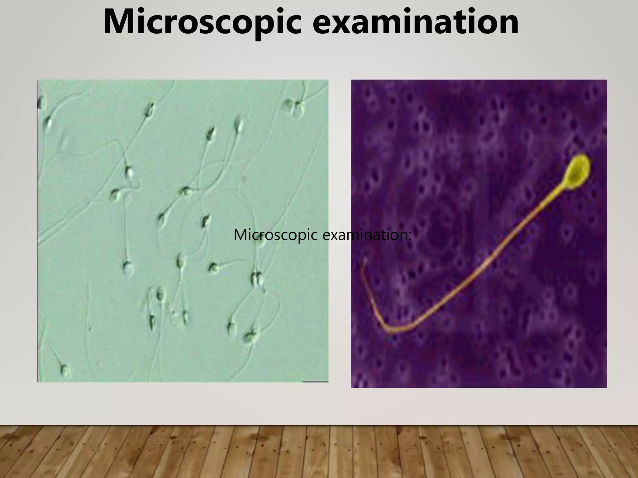 Semen Analysis | PPTX