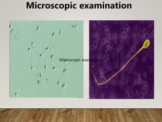 Semen Analysis | PPTX