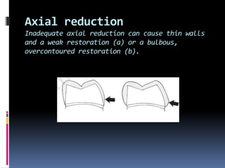 FIXED PARTIAL DENTURE -DESIGN CONSIDERATION | PPTX