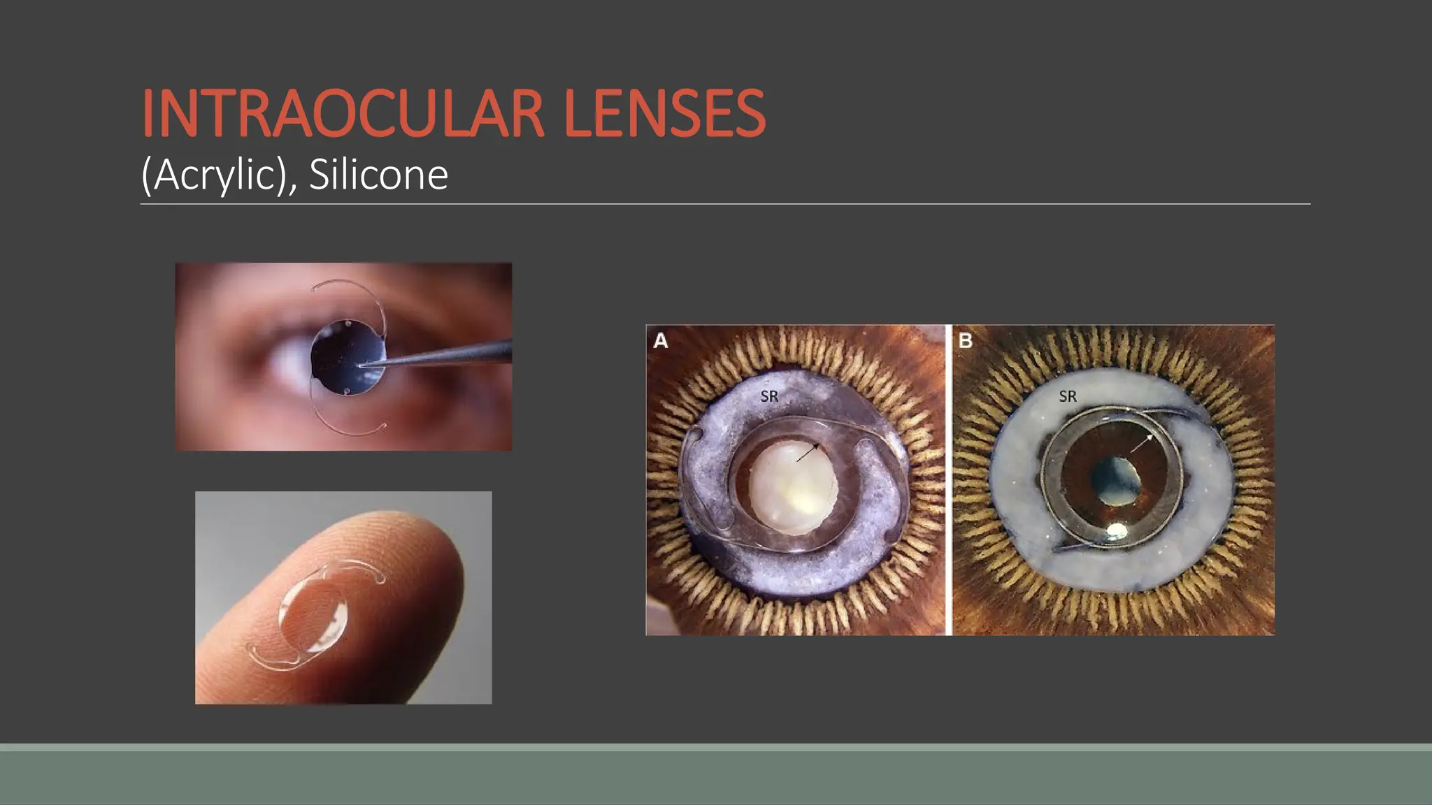 SEMICONDUCTORand-BIOMATERIALS Report-.pptx