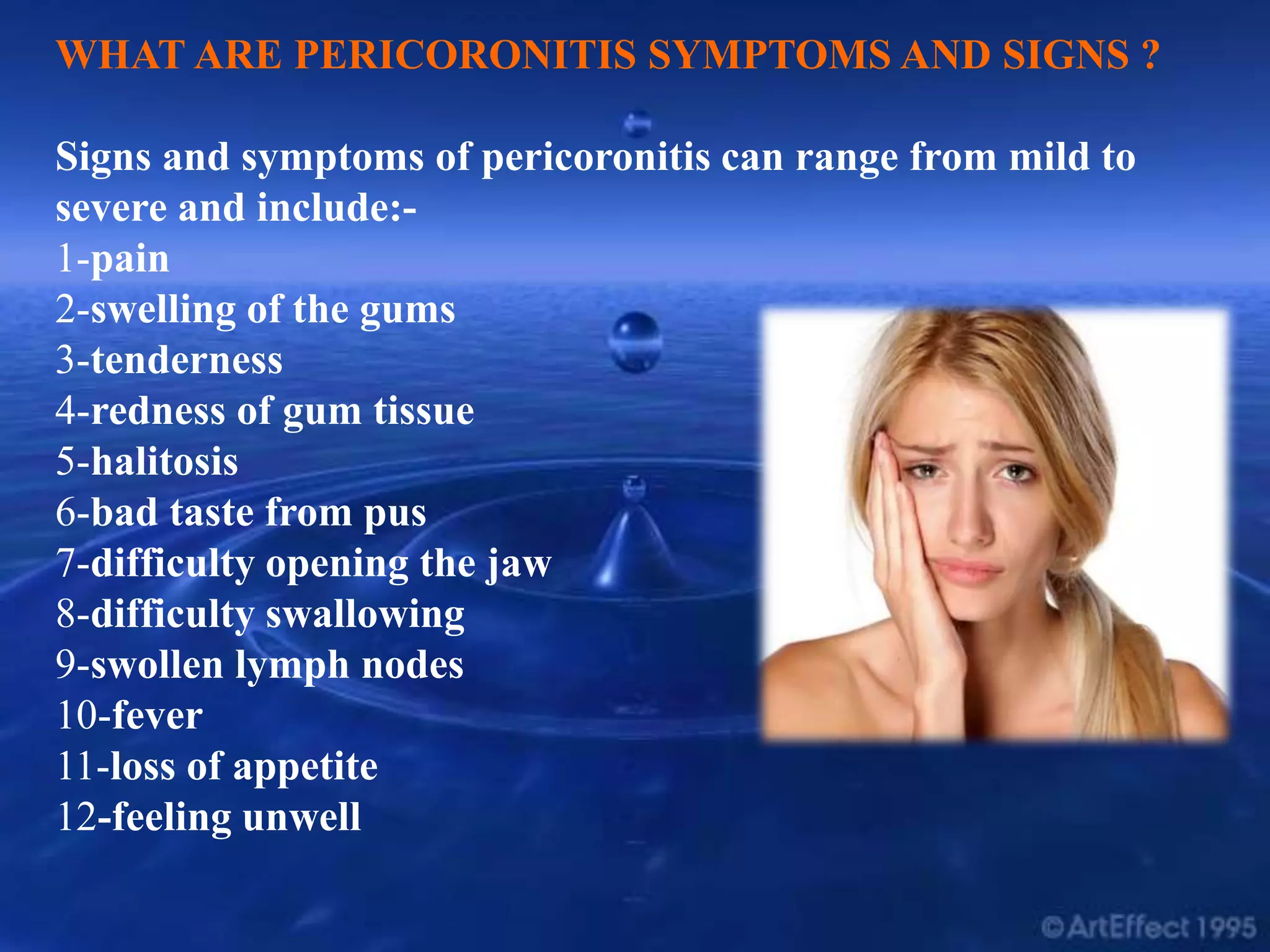 Pericoronitis | PPT
