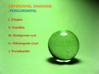 Pericoronitis | PPT