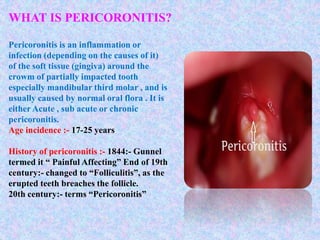 Pericoronitis Infection