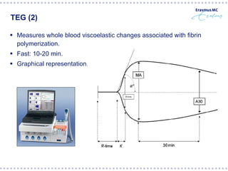 Management of coagulation and transfusion therapy in cardiothoracic ...