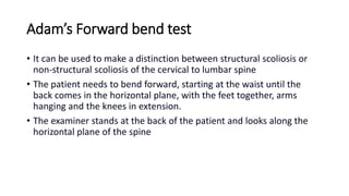 SCOLIOSIS assessment, types and management | PPTX