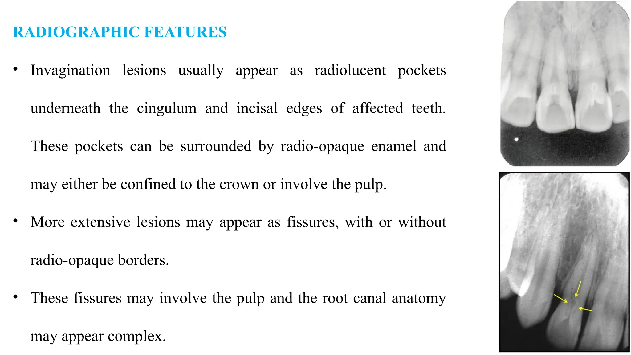 oral hamartoma hamartoma of odontogenic origin part 1. pptx | PPTX