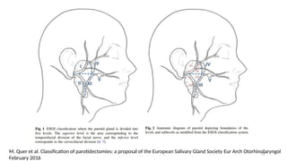 SEMINAR-11.pptx parotidectomy and submandibular salivary gland excision ...