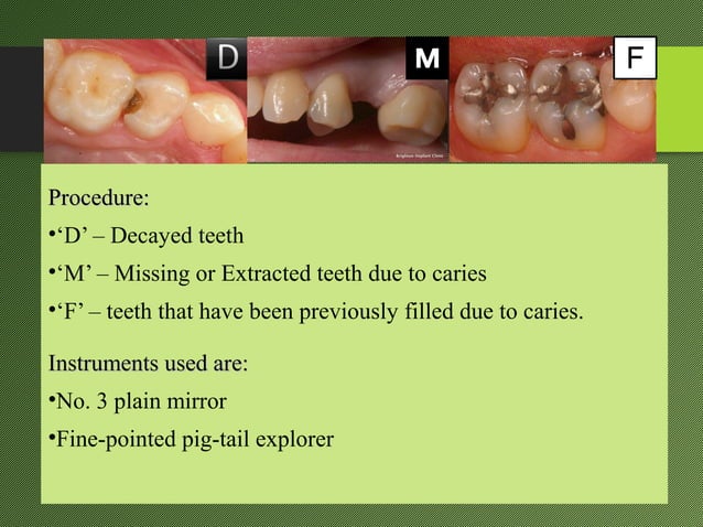 Indices for dental caries | PPT