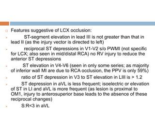 ECG LOCALISATION OF CULPRIT ARTERY IN STEMI | PPTX