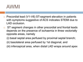 ECG LOCALISATION OF CULPRIT ARTERY IN STEMI | PPTX