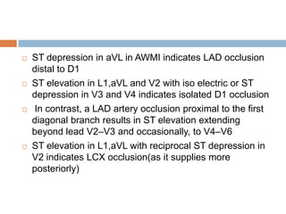 ECG LOCALISATION OF CULPRIT ARTERY IN STEMI | PPTX