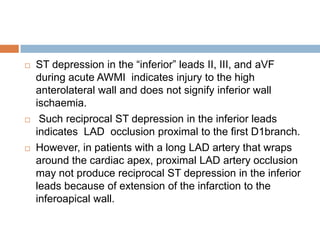 ECG LOCALISATION OF CULPRIT ARTERY IN STEMI | PPTX
