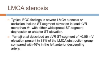 ECG LOCALISATION OF CULPRIT ARTERY IN STEMI | PPTX