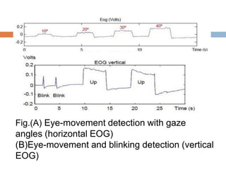 A project on wheelchair motion control using eye gaze and blinks | PPTX