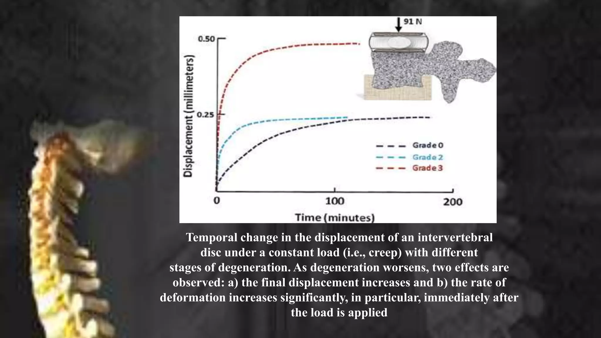 Effects Of Aging on Spine | PPTX