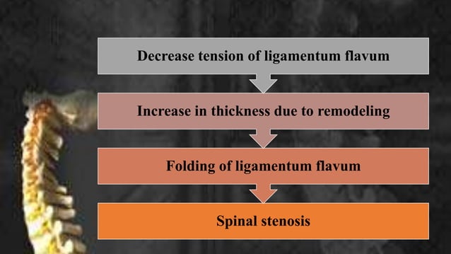 Effects Of Aging on Spine | PPTX