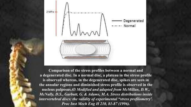 Effects Of Aging on Spine | PPTX