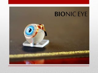 ARTIFICIAL RETINA/EYE (ASR,BIONIC EYE) | PPTX