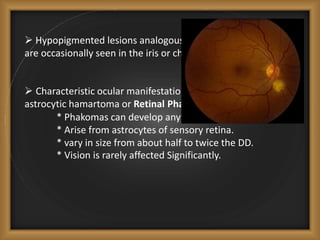 Phakomatoses(Ophthalmology) | PPTX