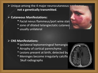 Phakomatoses(Ophthalmology) | PPTX