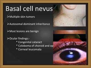 Phakomatoses(Ophthalmology) | PPTX