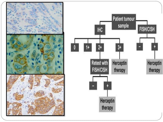 IHC in breast pathology | PPTX