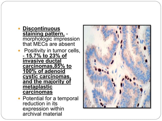 IHC in breast pathology | PPTX