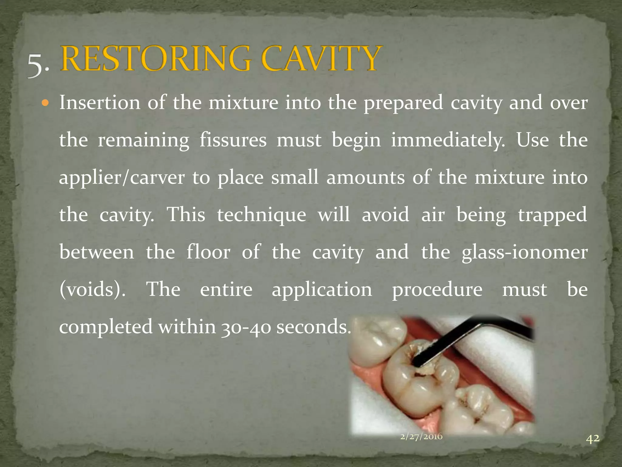 atraumatic restorative treatment | PPTX