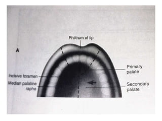 PRENATAL AND POST NATAL GROWTH AND DEVELOPMENT OF NASOMAXILLARY COMPLEX ...