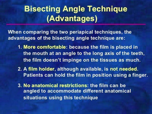 Bisecting angle technique | PPTX