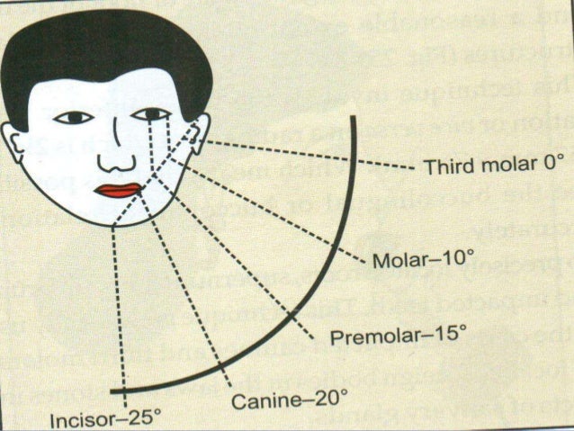 Bisecting angle technique