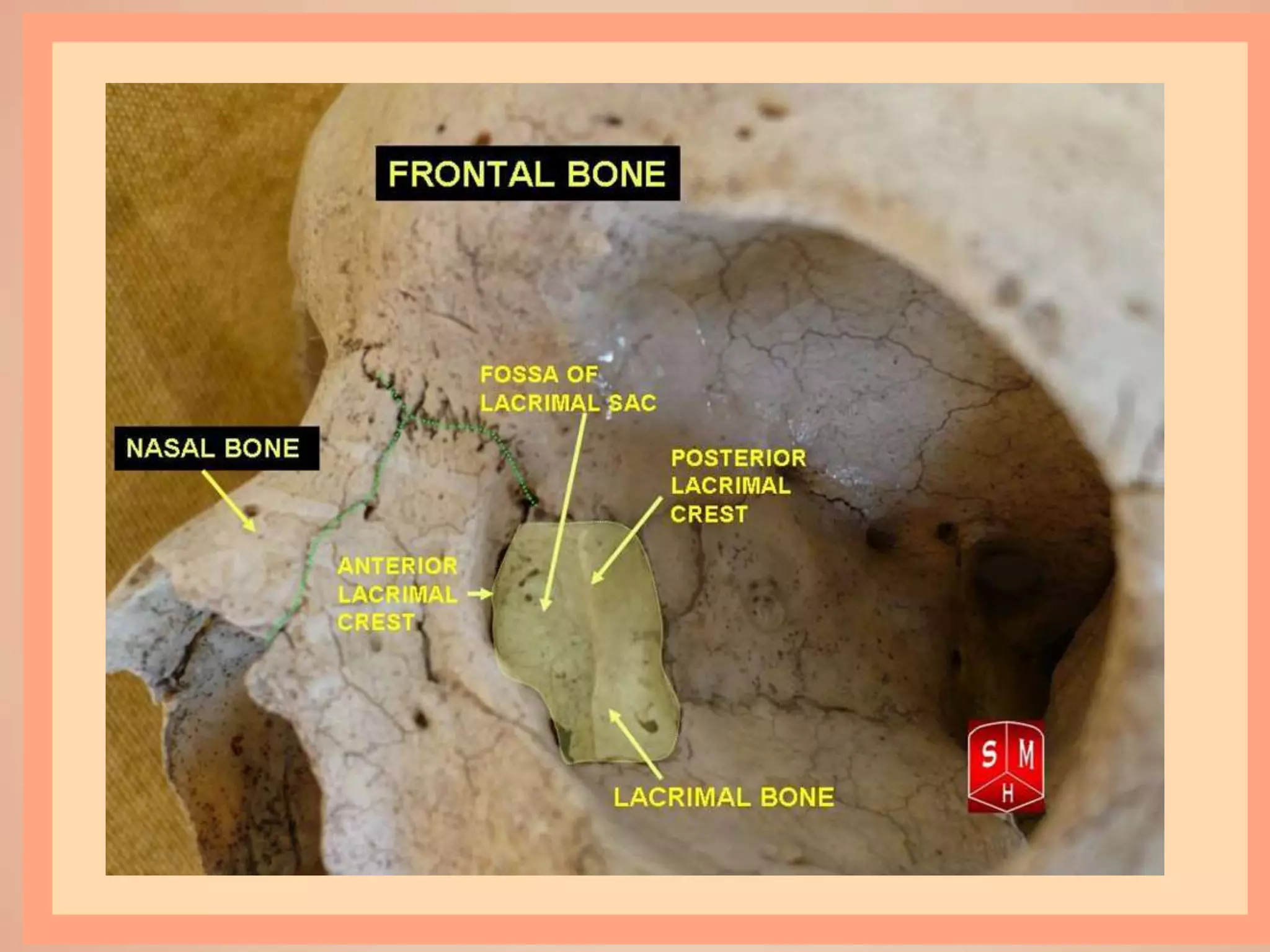 Radiographic anatomy of the face | PPTX