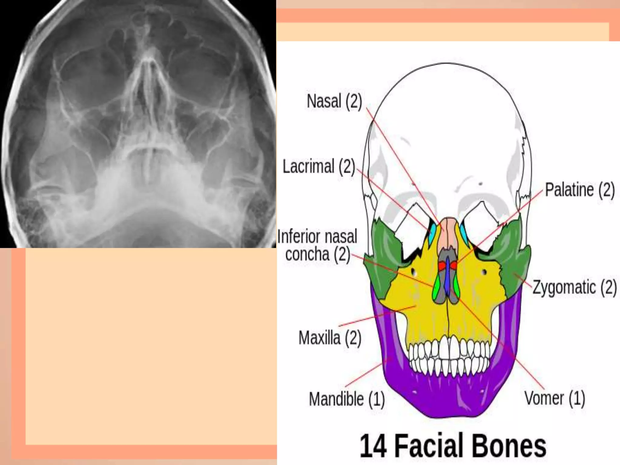 Radiographic anatomy of the face | PPTX