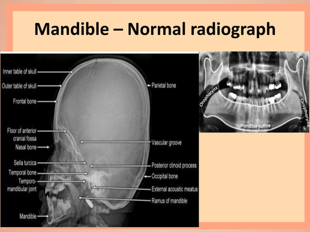 Radiographic anatomy of the face | PPTX