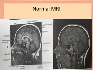 Radiographic anatomy of the face | PPTX
