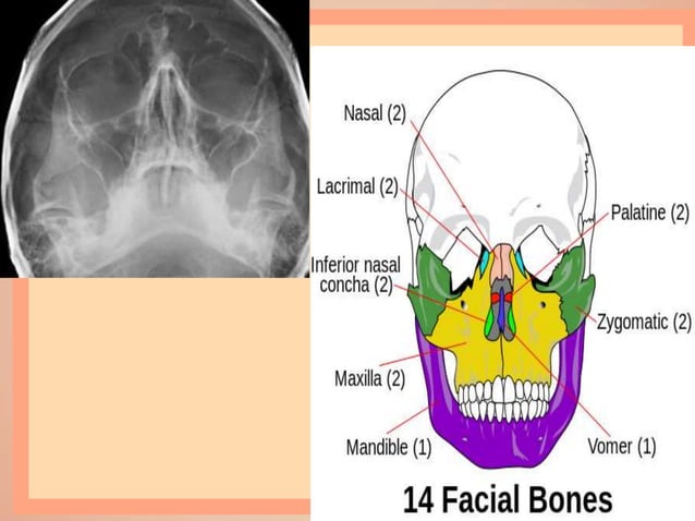 Radiographic anatomy of the face | PPTX