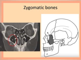 Face Bone Anatomy Ct