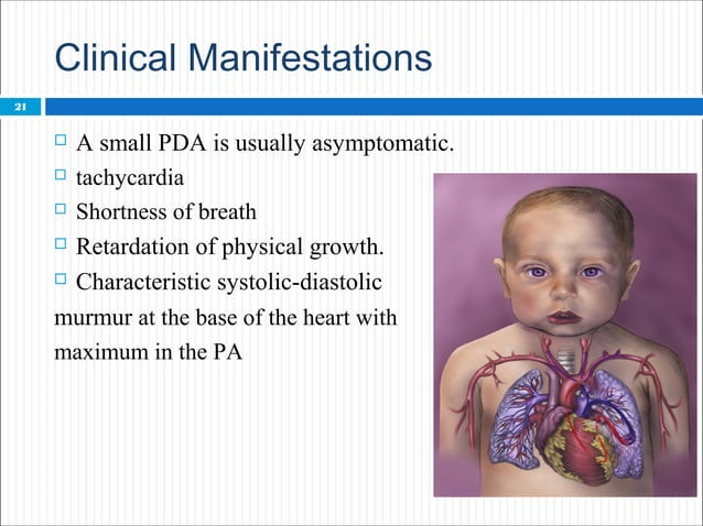 pediatrics congenital heart disease | PPT | Heart and Cardiovascular ...
