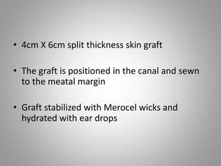 CONGENITAL MALFORATION OF EAR AND ITS MANAGEMENT | PPTX