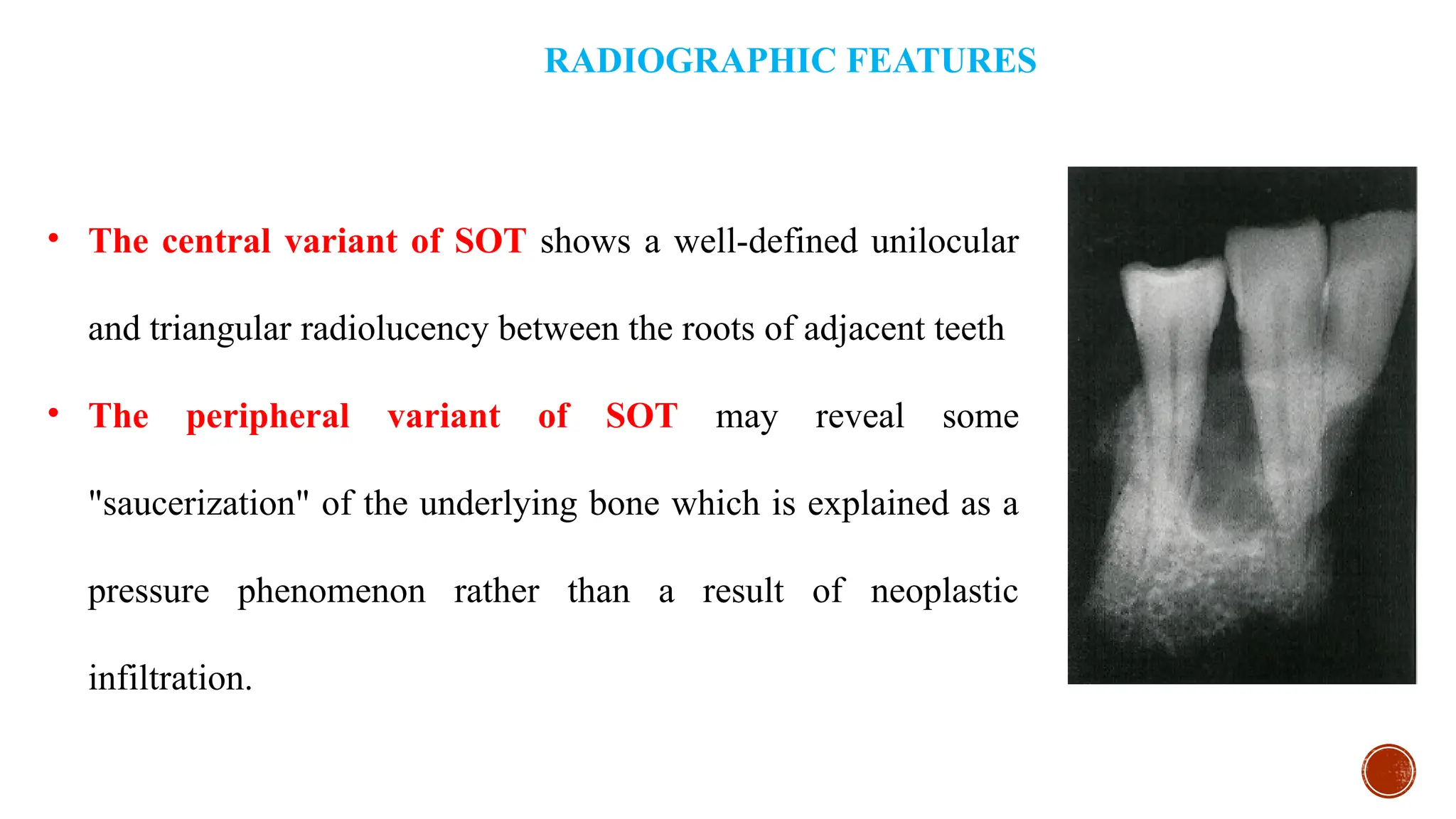 oral hamartomas detailed second part.pptx