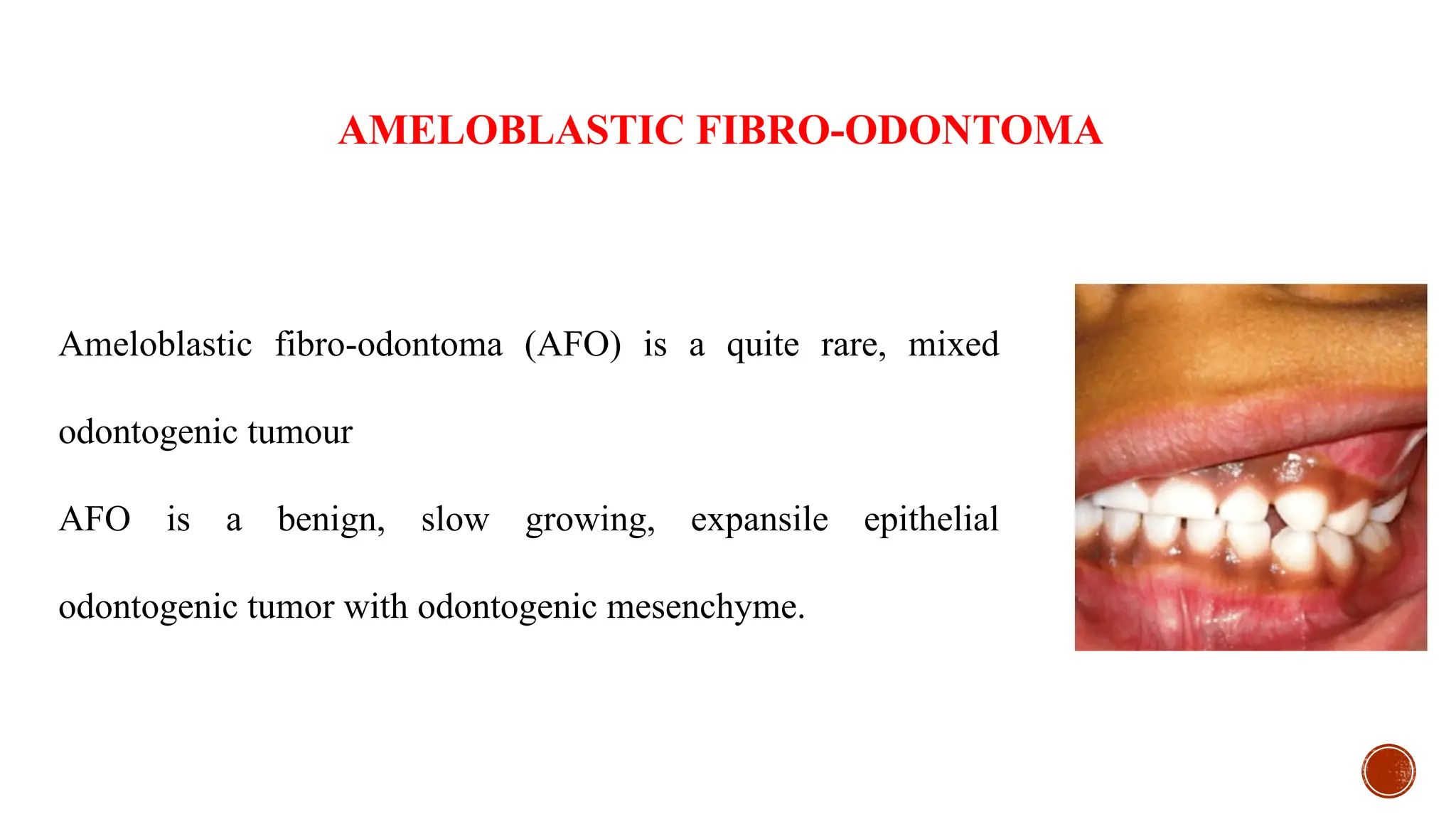 oral hamartomas detailed second part.pptx