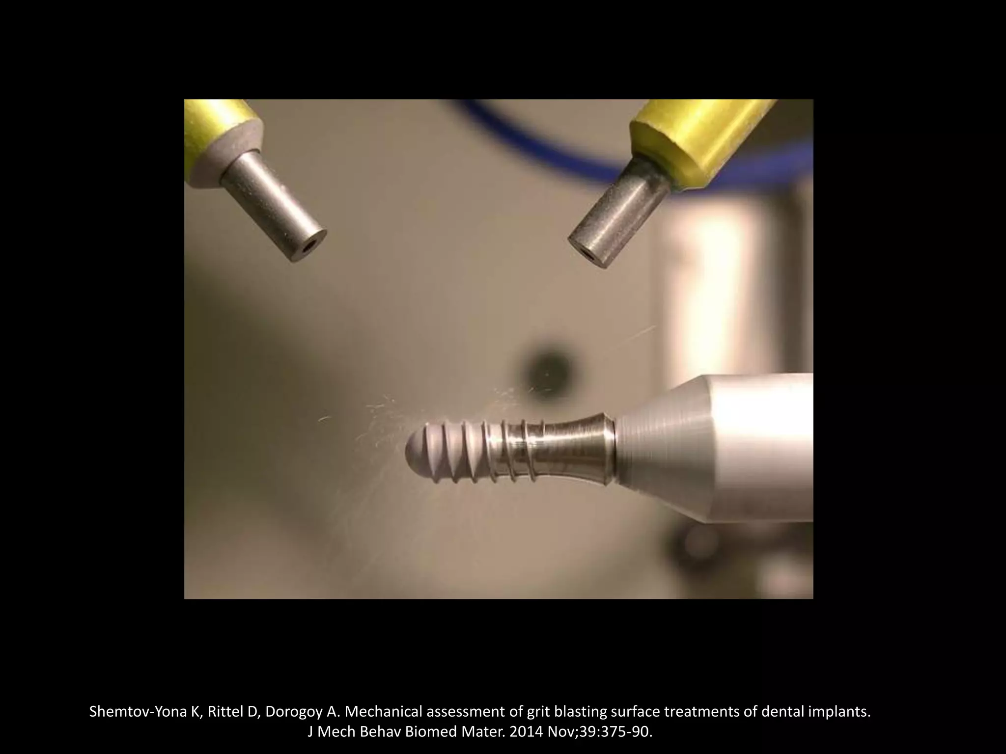 Implant design | PPTX