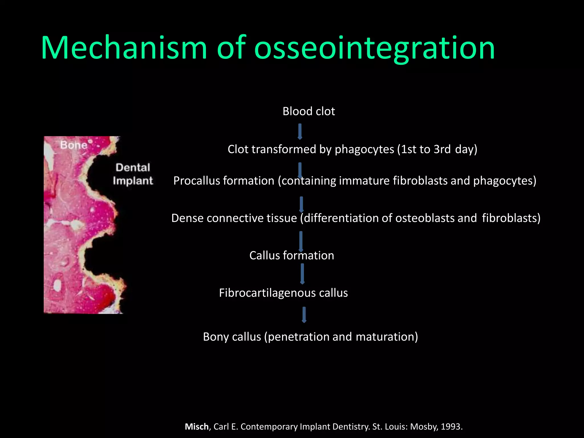 Implant design | PPTX