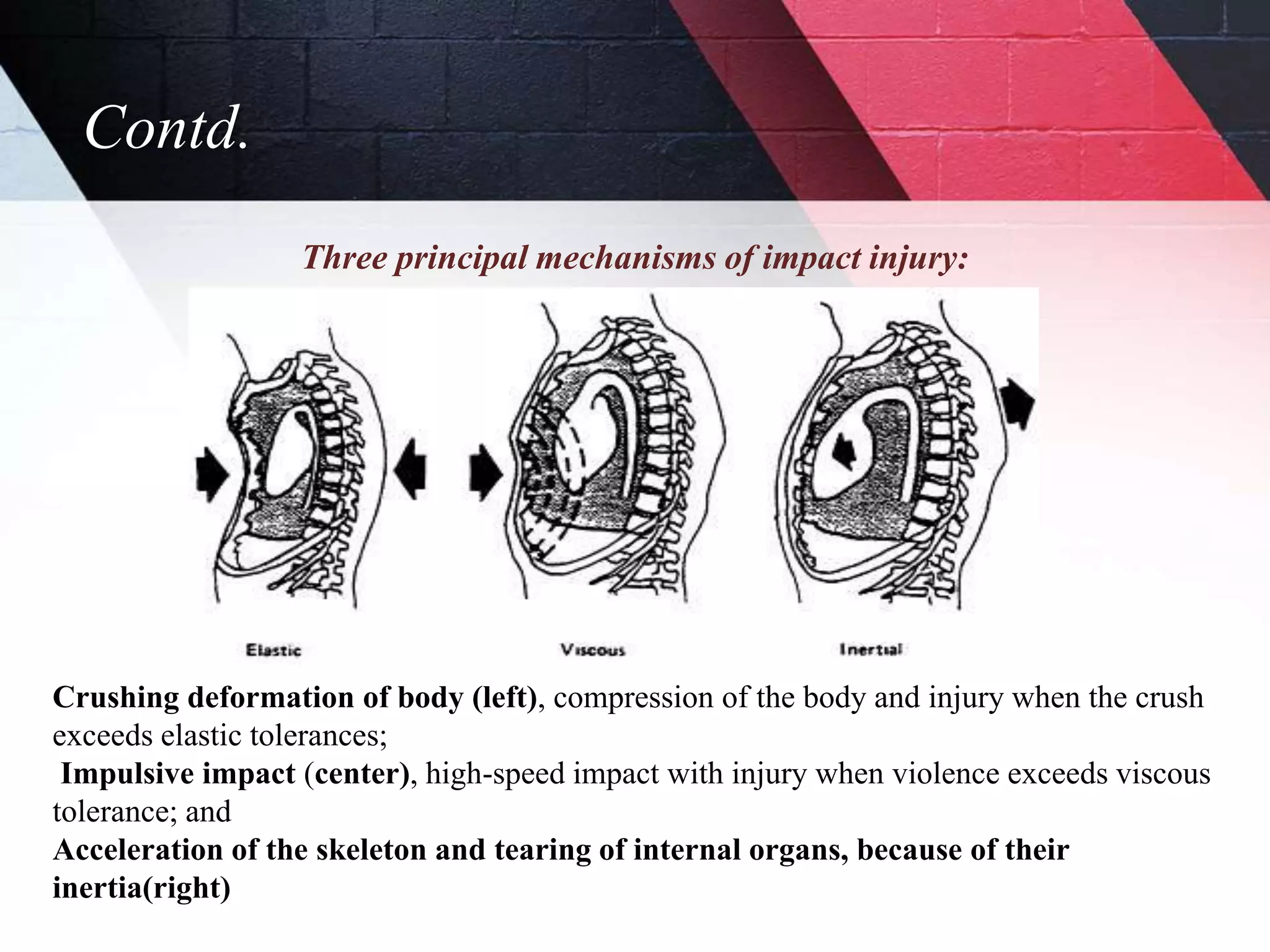 Biomechanics of Injury | PPTX