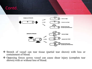 Biomechanics of Injury | PPTX