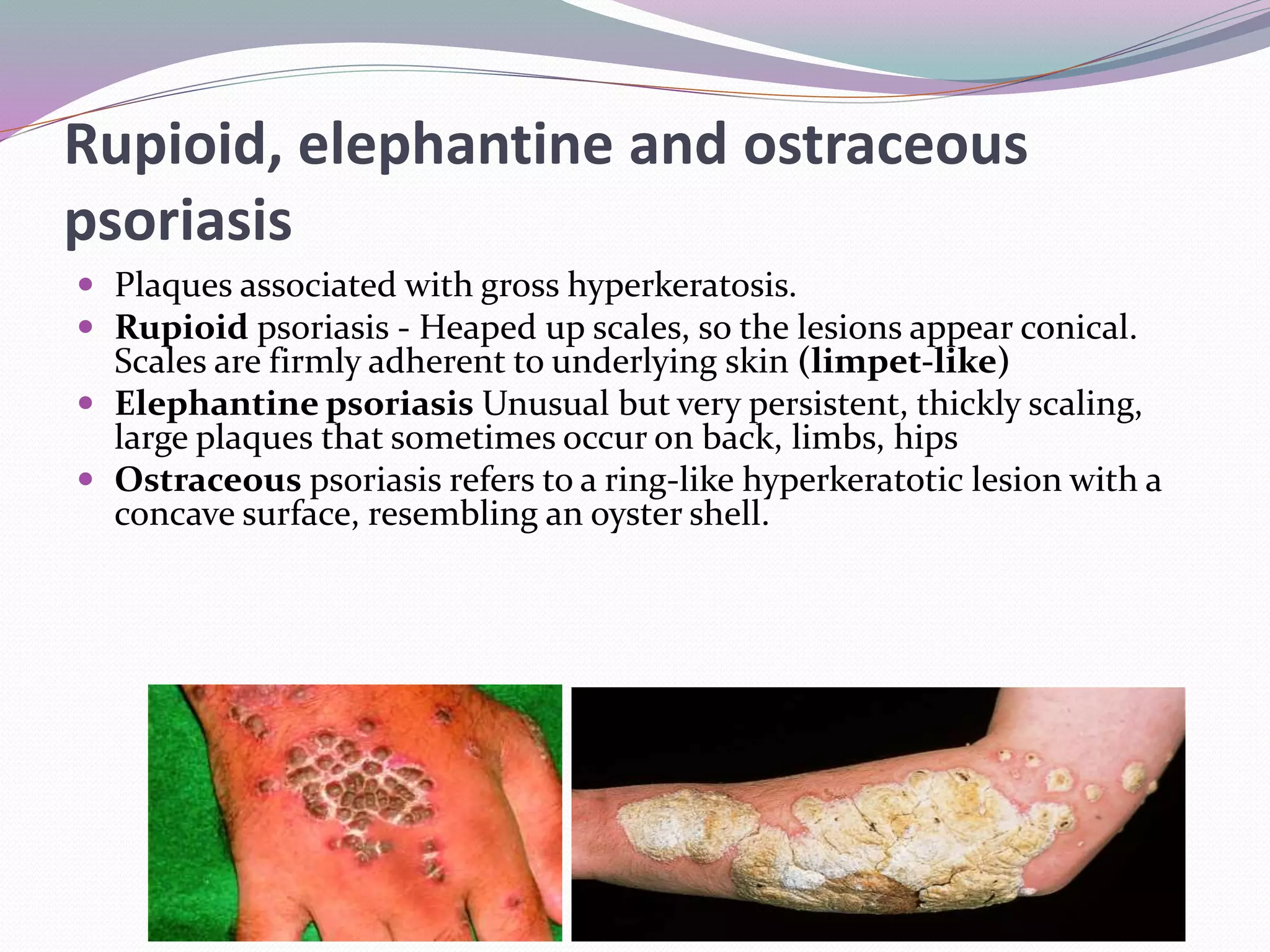 Seminar clinical approach to papulosqamous disorders. | PPTX